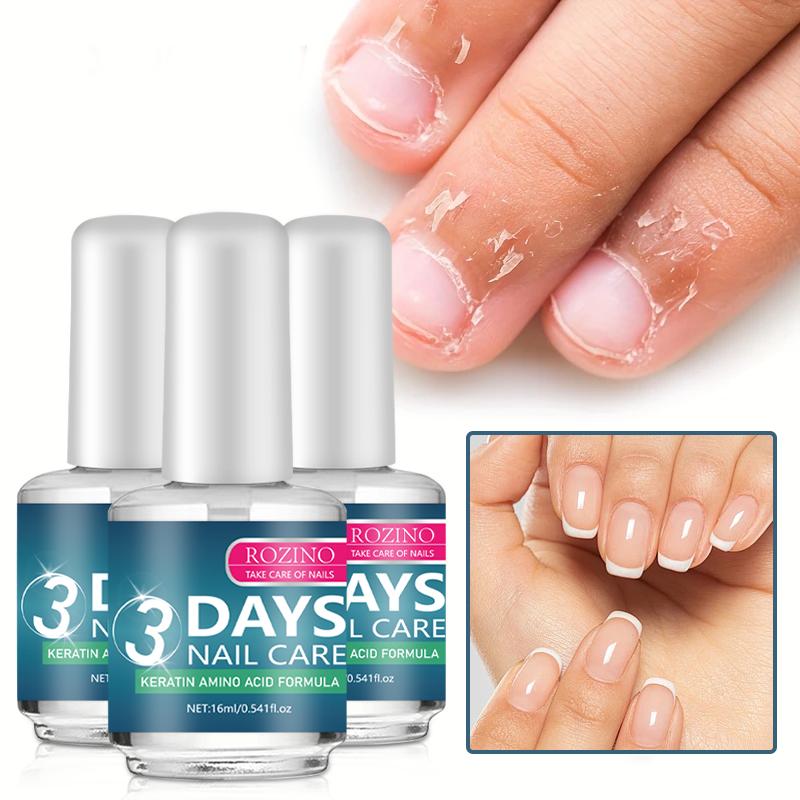 ROZINO 3 Days Nail Care - Keratin Amino Acid Formula for Superior Nail ...