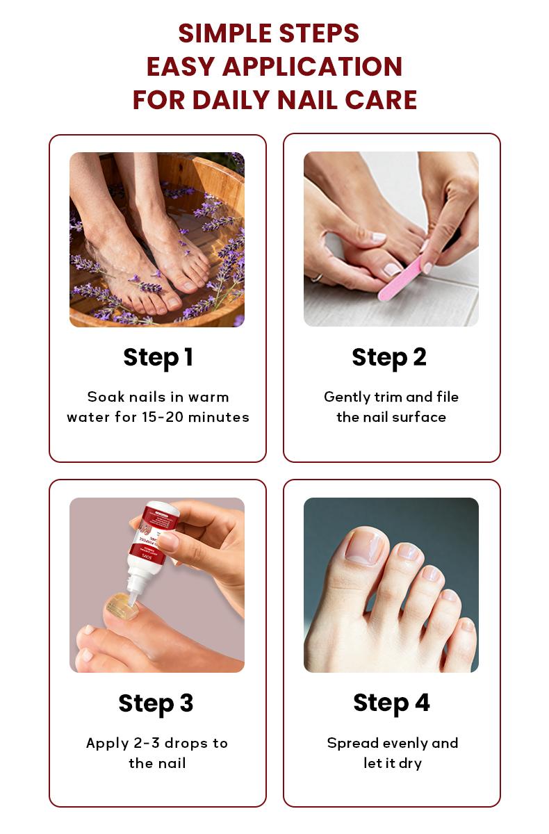 SOVS Toenail Fungus Treatment Extra Strength, Antifungal Solution for ...